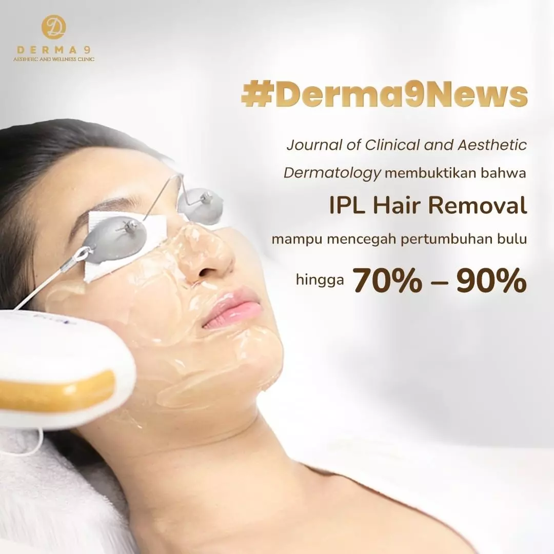 Treatment IPL Hair Removal di DERMA9 Klinik Kecantikan Solo - Derma9 ...
